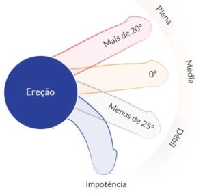 Tipos de Ereção | Quais ereções que o homem pode ter?